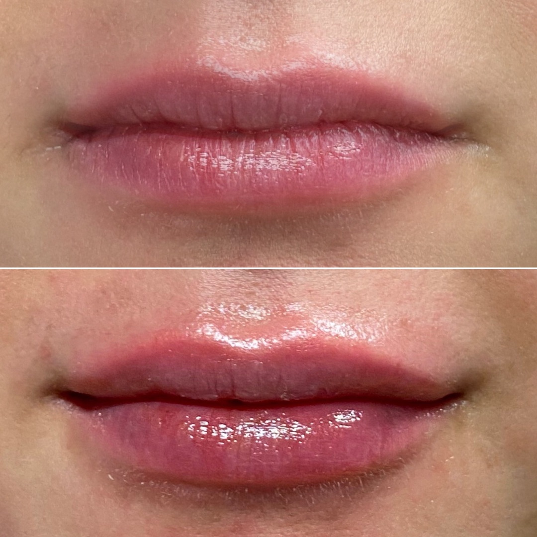 Before & After Images – Face - Australian Skin Face Body