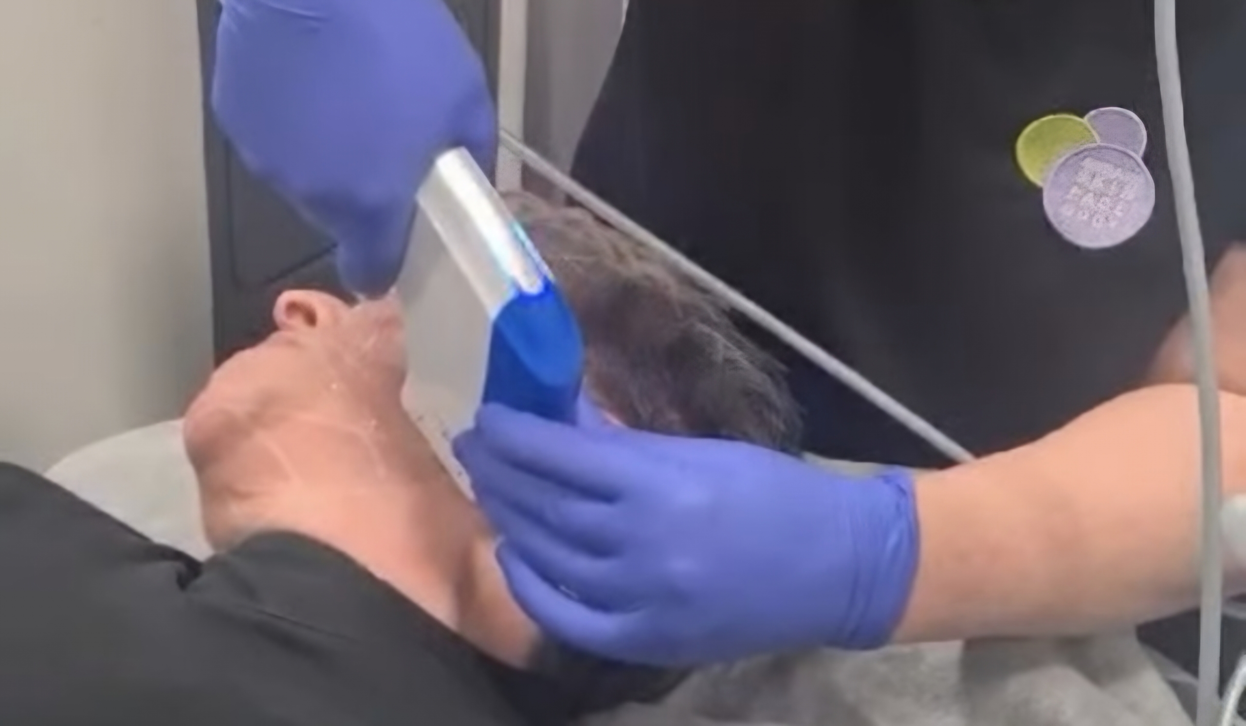 Tightening Your Skin with Ultraformer - Australian Skin Face Body